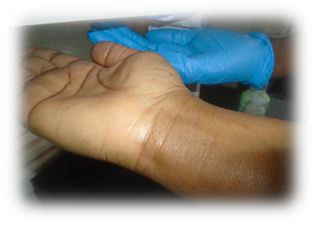 Reducing Unnecessary Glove Use: A Sustainable Approach to Infection ...
